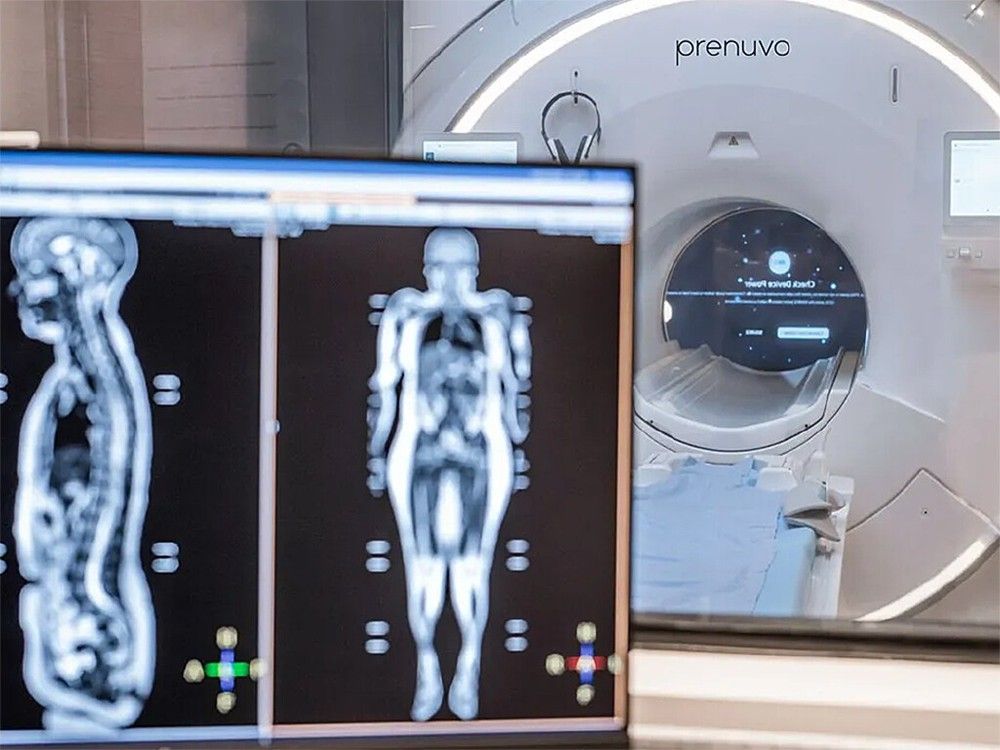 Health P.E.I. paying for patients to get MRIs in N.B. private clinic ...