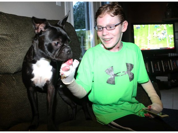 Jonathan Pitre, the Butterfly Boy, has passed away | Ottawa Citizen