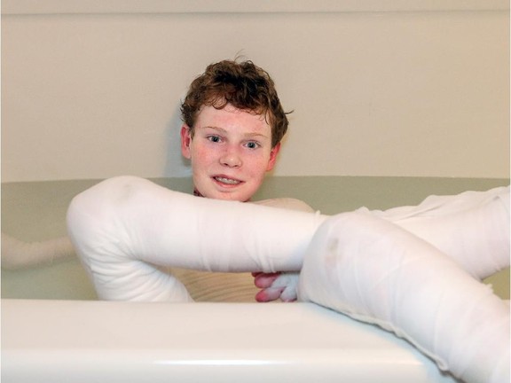 Jonathan Pitre, the Butterfly Boy, has passed away | Ottawa Citizen