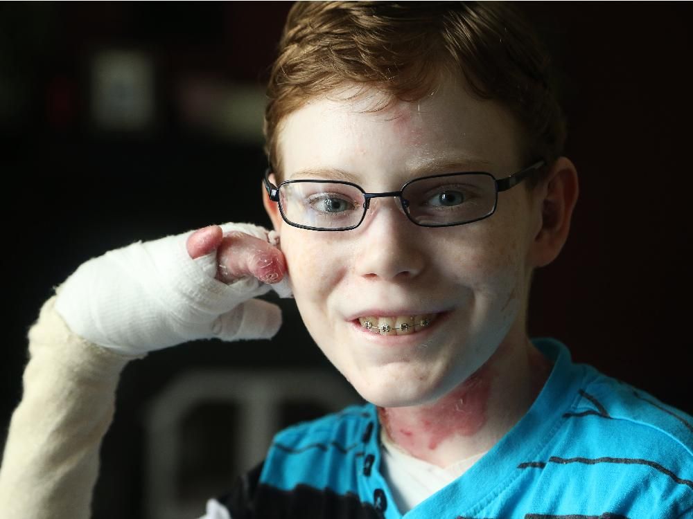 Jonathan Pitre, the Butterfly Boy, has passed away | Ottawa Citizen