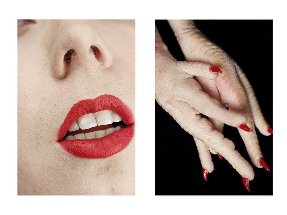 Discomfiting photographs of the human body | Ottawa Citizen