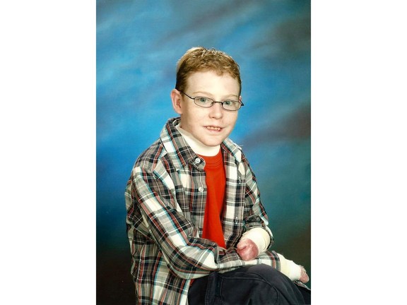 Jonathan Pitre, the Butterfly Boy, has passed away | Ottawa Citizen