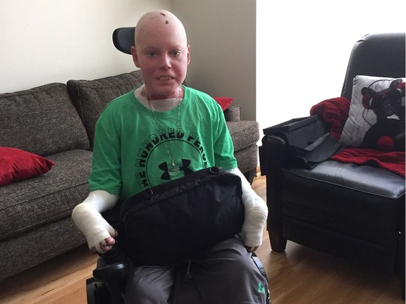 Jonathan Pitre, the Butterfly Boy, has passed away | Ottawa Citizen