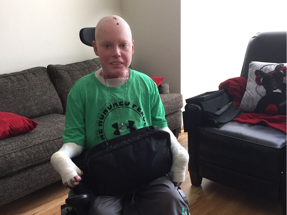 Jonathan Pitre battles new infection in Minnesota hospital | Ottawa Citizen