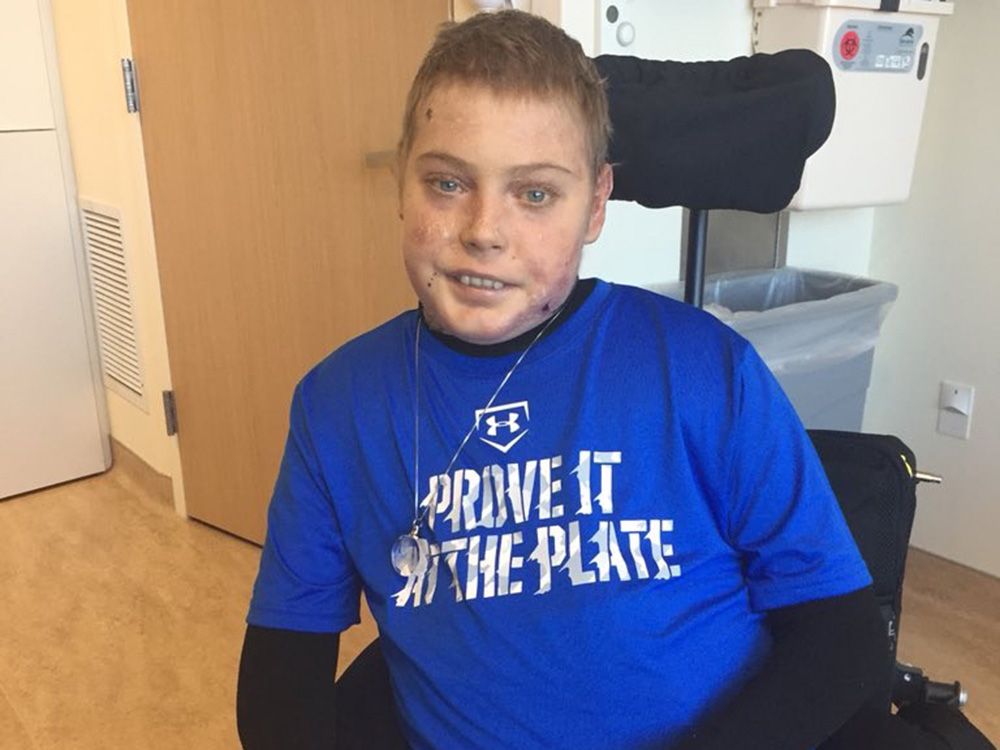 Jonathan Pitre, the Butterfly Boy, has passed away | Ottawa Citizen