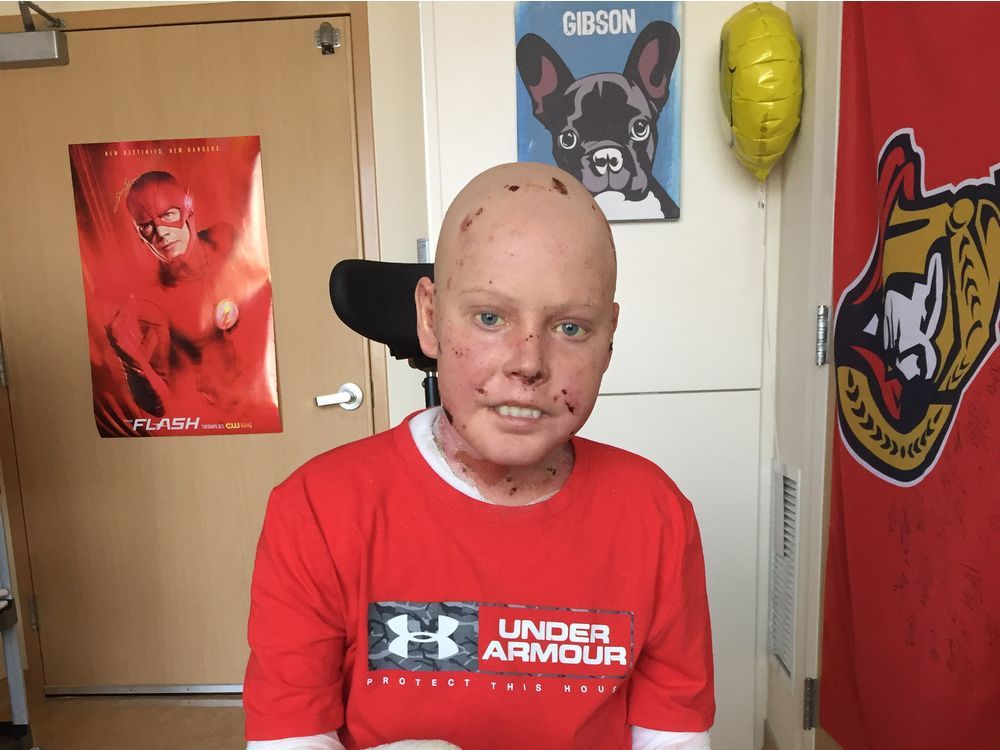 Jonathan Pitre, the Butterfly Boy, has passed away | Ottawa Citizen