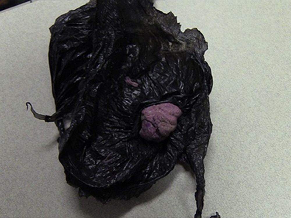 Police seize drugs in new format: 'purple putty' | Ottawa Citizen