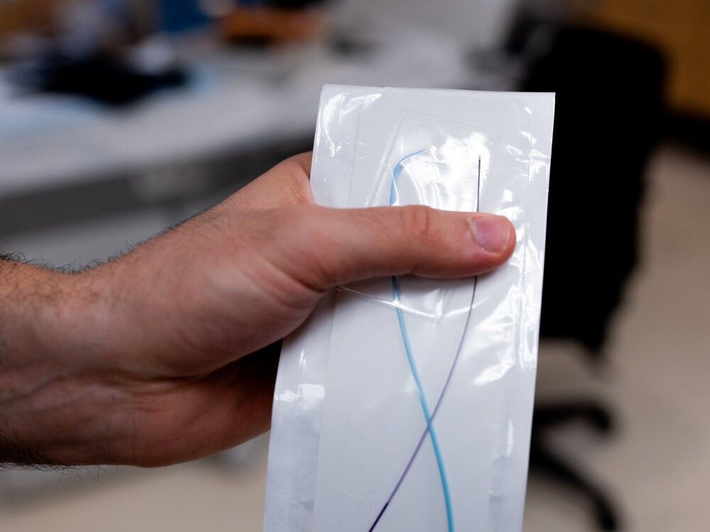 How a really tiny camera could revolutionize stroke treatment | Ottawa ...