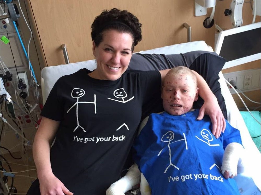 Jonathan Pitre's lessons for us all | Ottawa Sun