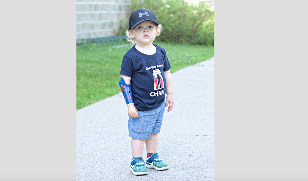 Two year-old Clarenville boy member of the War Amps Child Amputee ...
