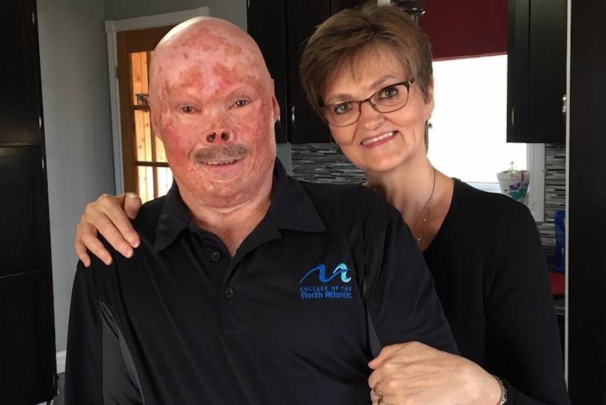 Thirteen years after a devastating explosion, Pat Stamp remains close ...