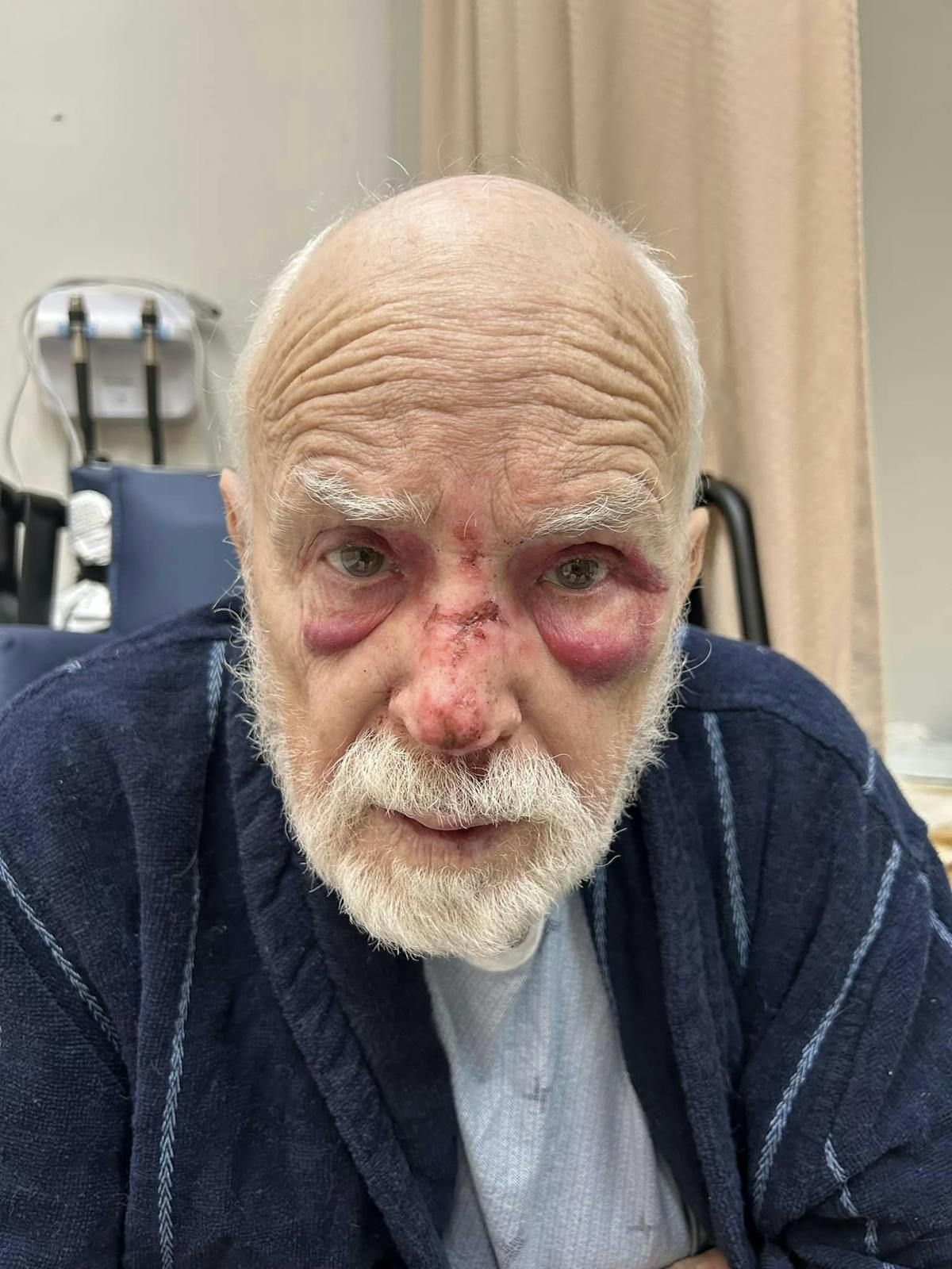 'They told us he was safe there': 79-year-old man left with broken nose ...