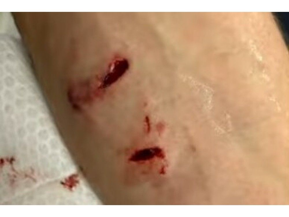 Halifax exploring a tighter leash on dangerous dog rules | PNI Atlantic ...