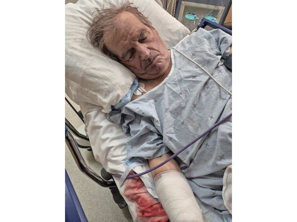 Pouch Cove dog attack leaves man facing life-changing injuries | PNI ...