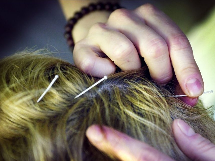 Police Lay More Charges Against Acupuncturist Accused Of Sexual Assault Toronto Sun 4811