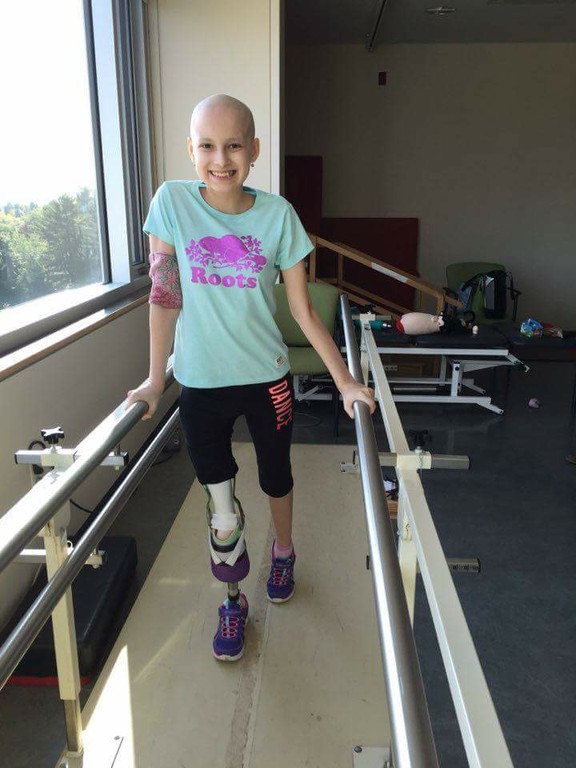 Toronto amputee's love of dance lands her on talent show | Toronto Sun