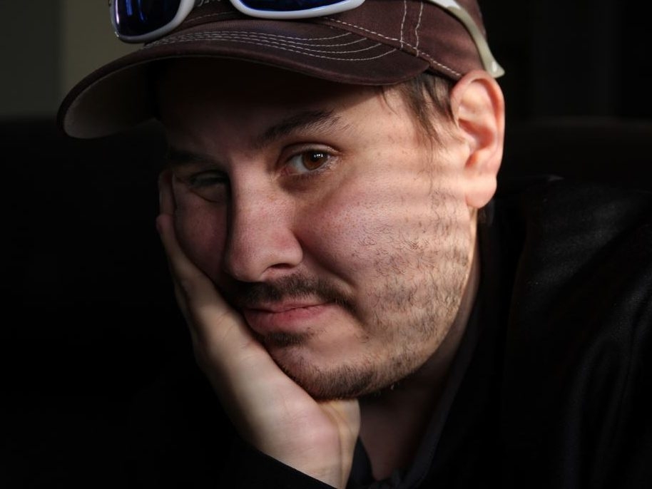 Barrie man blinded in random pellet gun attack | Toronto Sun