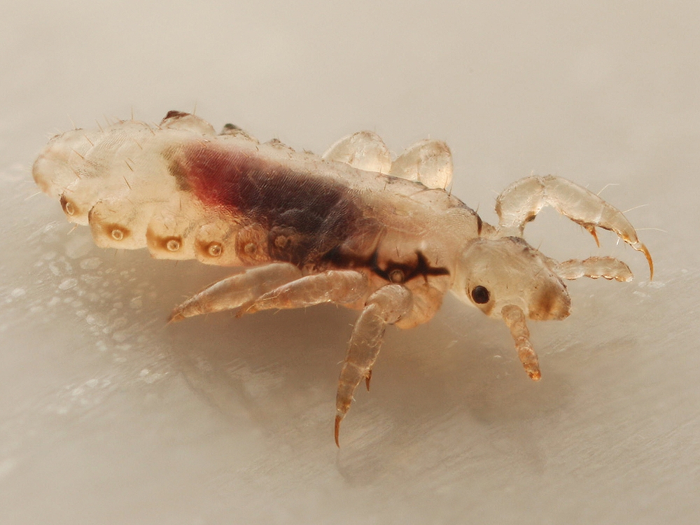 Beware of super lice this March Break | Toronto Sun