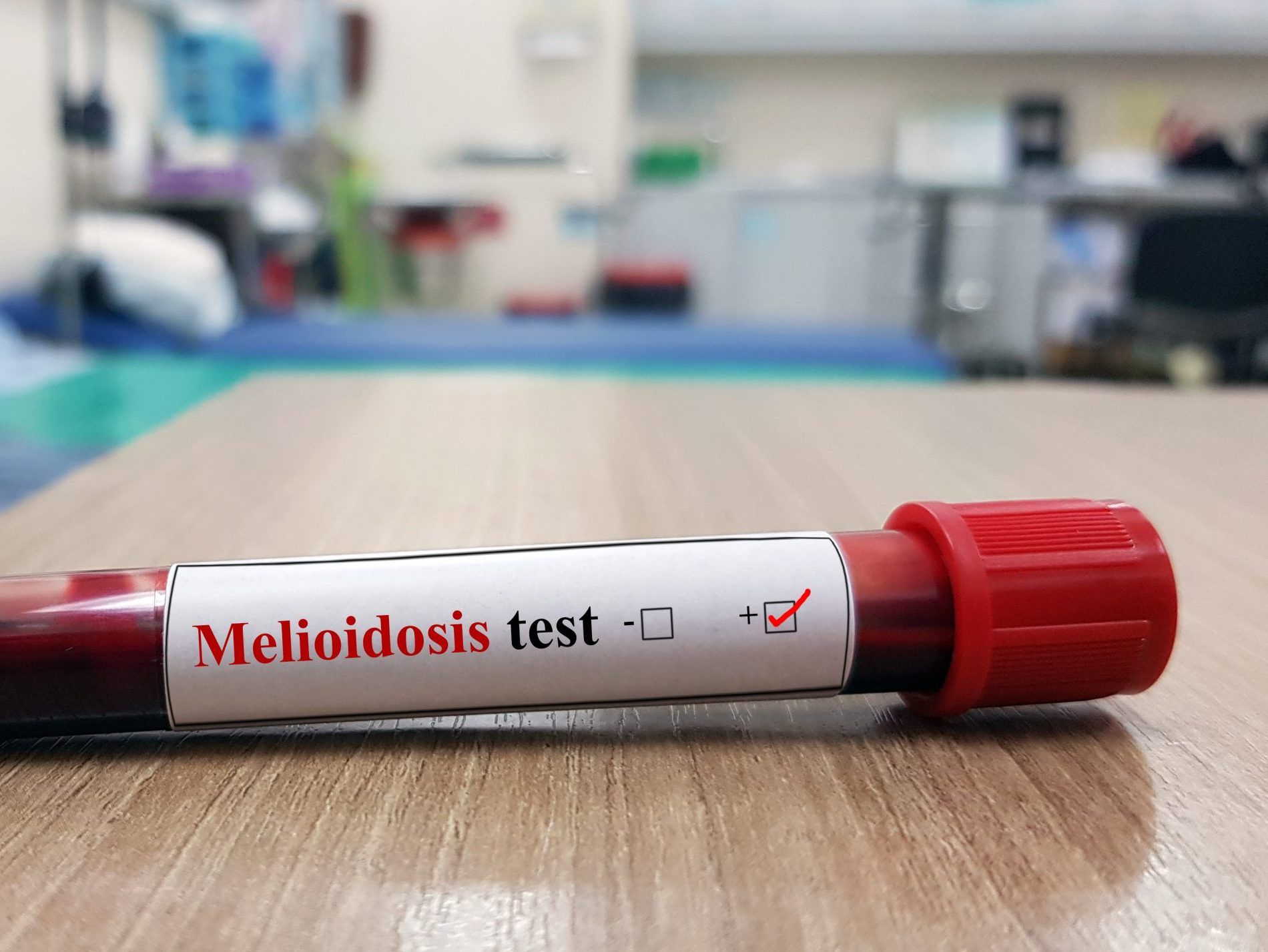 Rare bacterial outbreak kills one in Georgia: CDC | Toronto Sun