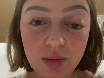 PUSH!: Childbirth makes woman’s eye pop out | Toronto Sun