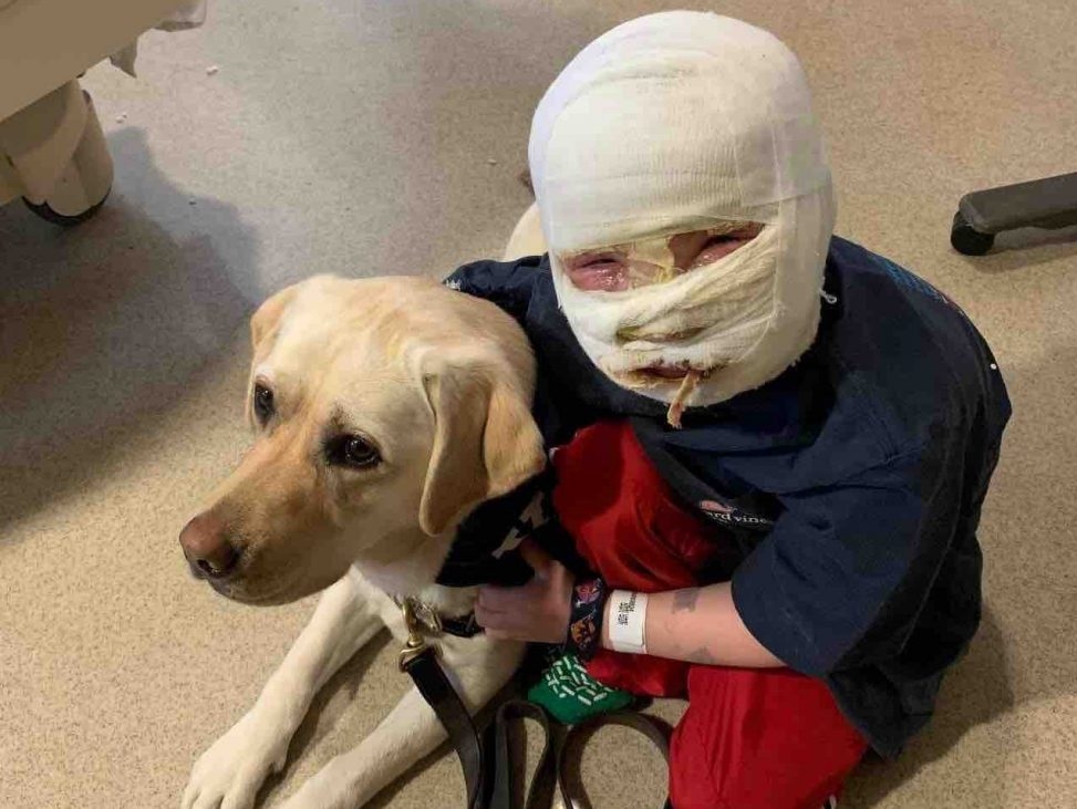 Child burned by alleged bully's flaming tennis ball | Toronto Sun