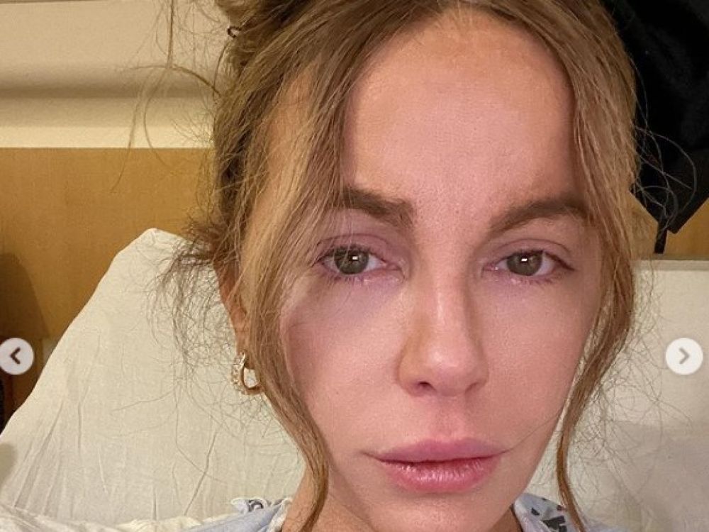 Kate Beckinsale reveals she's been hospitalized | Toronto Sun