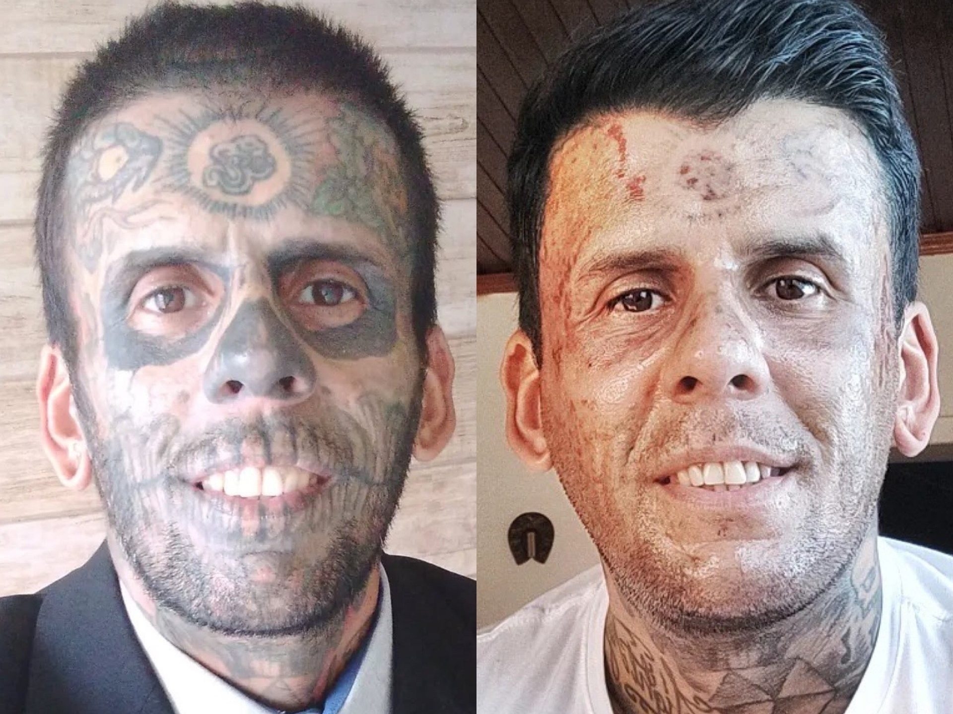 50 cent tattoos removed