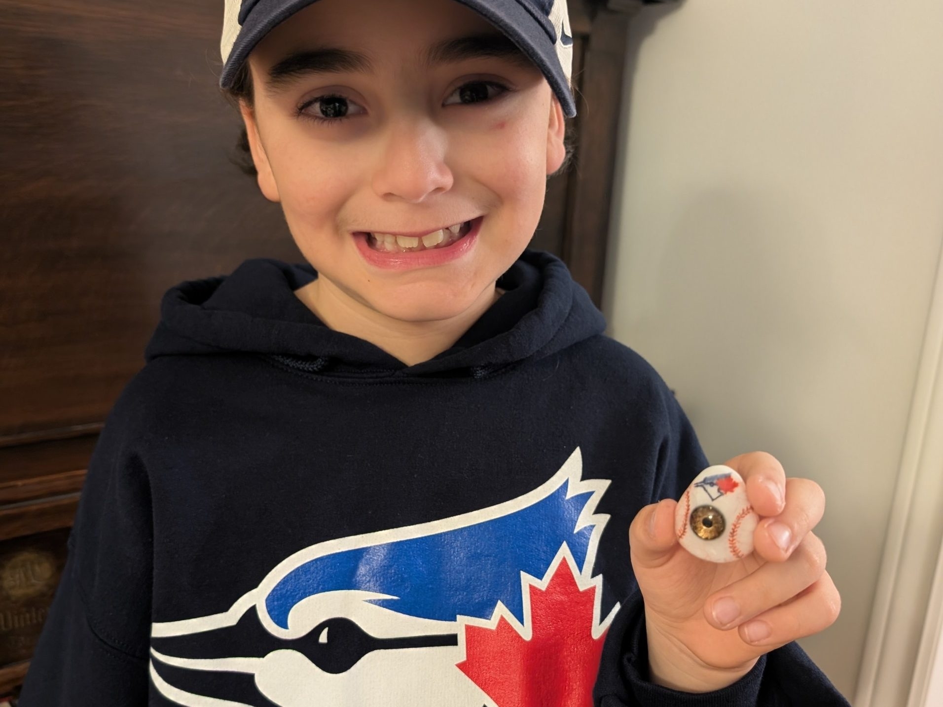 UMVA - Richmond Hill boy has 'fun eye' made to look like Blue Jays baseball