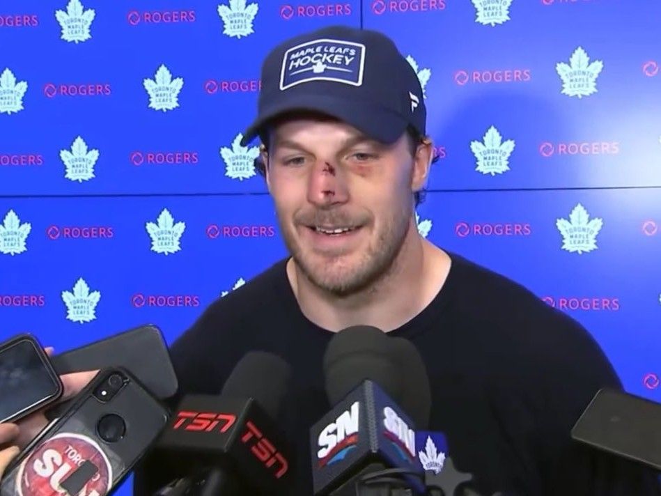 Let's face it, Maple Leafs Jake McCabe is still one tough hombre ...