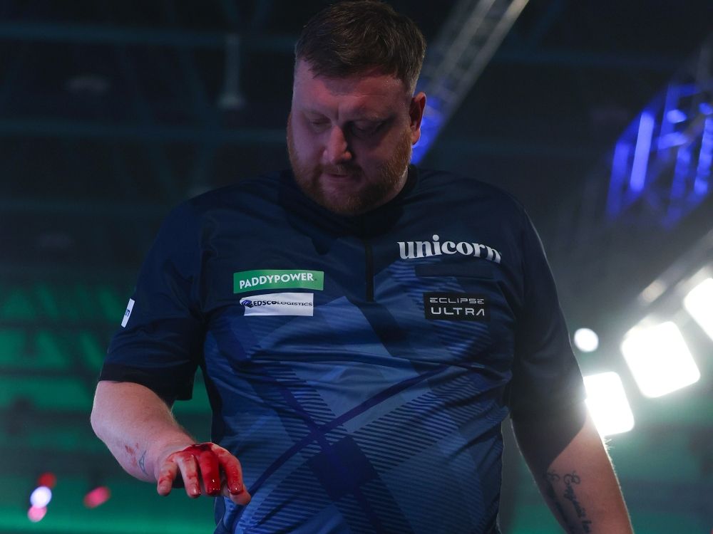 Cameron Menzies puts out firework with hand during rampage | Toronto Sun