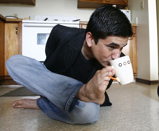 Armless man still hoping to climb Mt. Everest | Toronto Sun