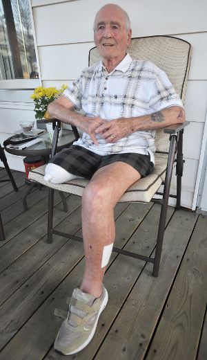 Roy Hamlyn calls his prosthesis his 'Terry Fox leg' | The Sarnia Observer