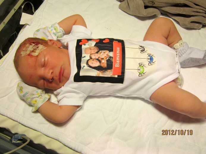 Parents file complaint after baby's head cut during C-section | Toronto Sun