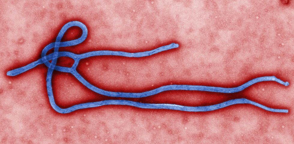 What you need to know about Ebola | Toronto Sun