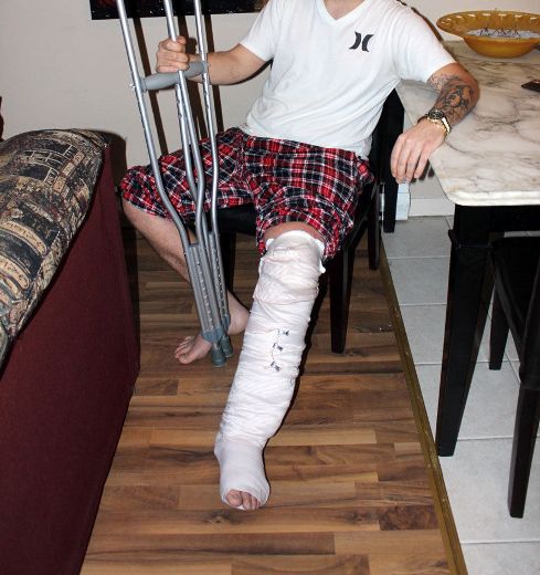 Man's leg crushed in Quebec road-rage chase | Toronto Sun