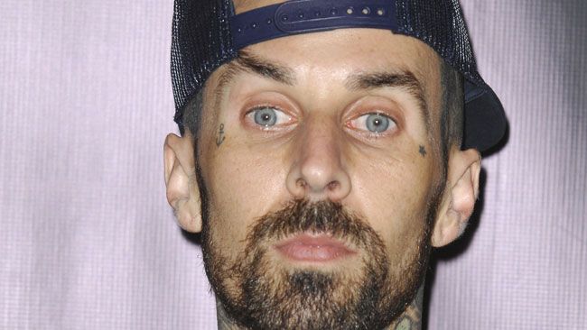Travis Barker: 'The drugs didn’t work during skin graft surgeries ...