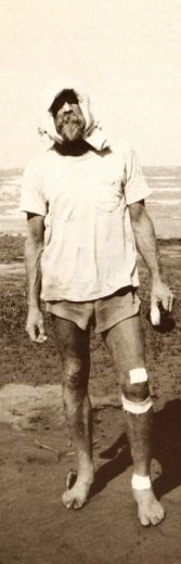 Adventurer Starkell loses battle with cancer | Winnipeg Sun