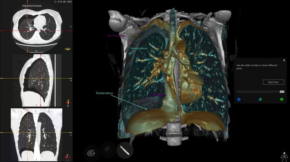 "iPad" imaging tool lets UBC medical students see human anatomy in 3D ...