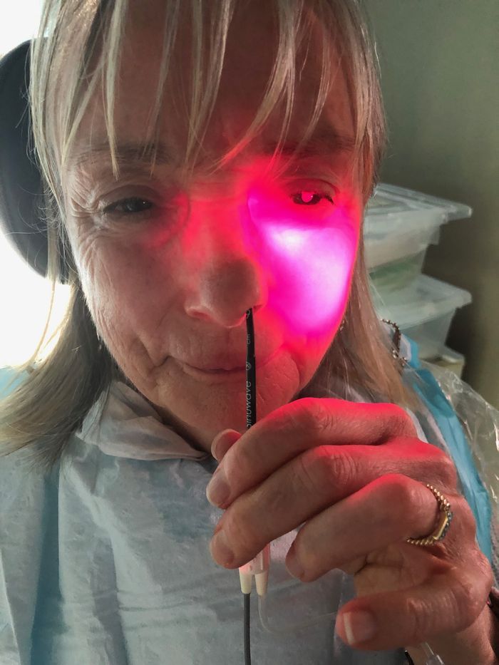 Believe it or snot: Nasal mucus transplant study targets bad sinuses ...