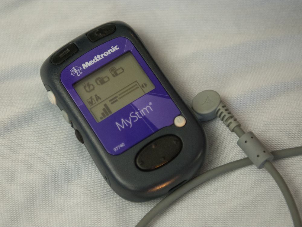 Spinal-cord stimulation helps back-pain patients ditch opiates ...