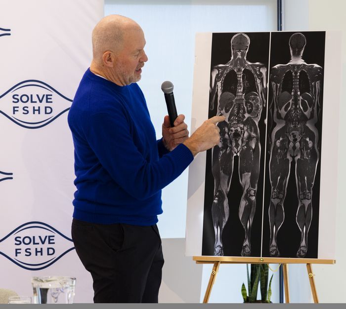 Chip Wilson gives $100 million to find cure for rare genetic disorder ...