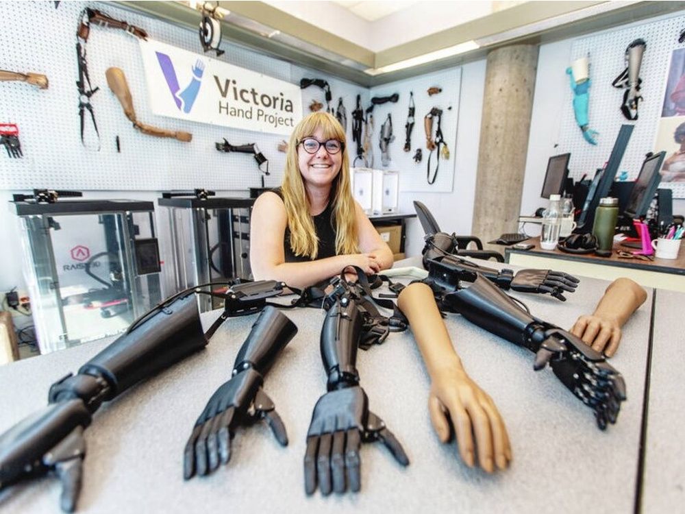 Victoria project hopes to give hand to Ukrainians injured in war ...