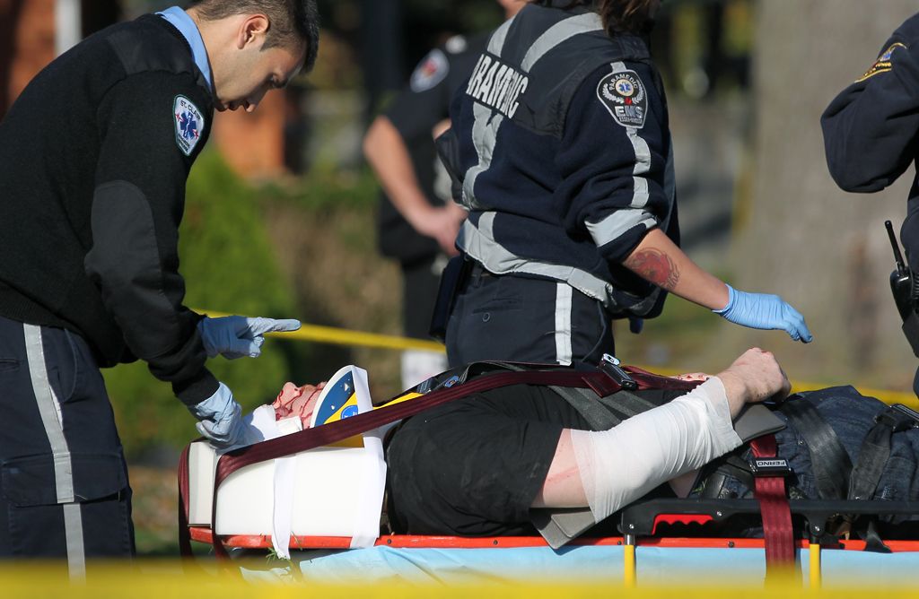 Victim sustains serious injuries in baseball bat attack in West Windsor ...