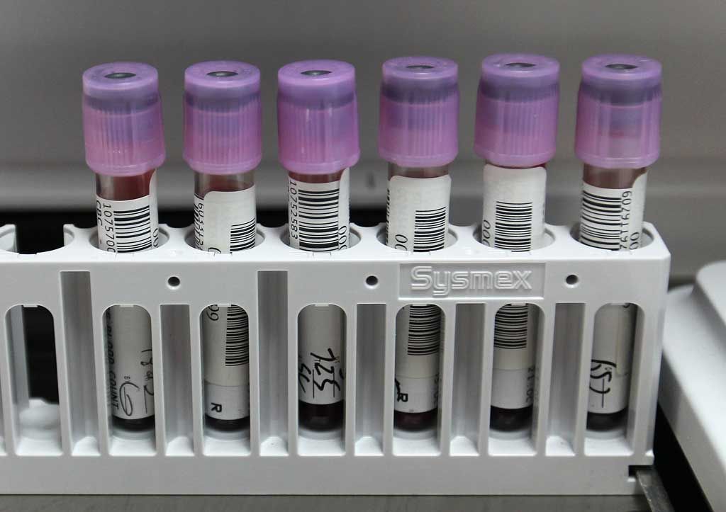 New technolgy reduces waits for hospital lab test results (with video ...