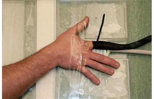 Joint study: scientists use MRI to examine knuckle-cracking | Windsor Star